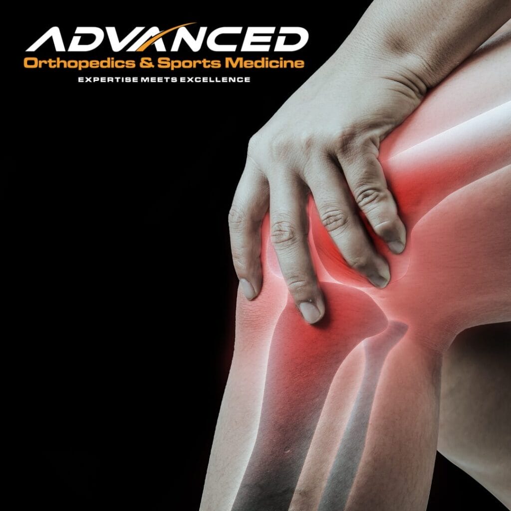 Exploring Orthopedic Options for Anterior Cruciate Ligament (ACL) Injuries | Advanced Orthopedic ...